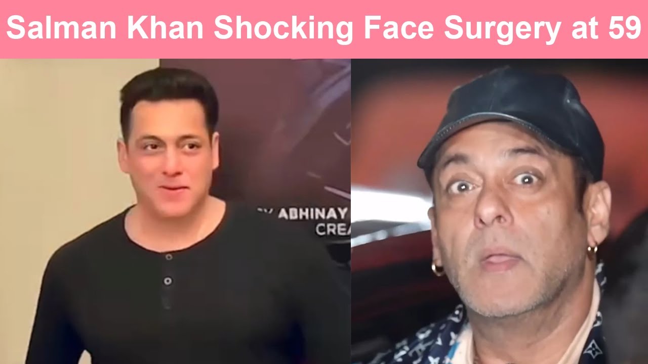 59 Years Old Salman Khan Shocking Face Surgery 😲😲😲 - YouTube