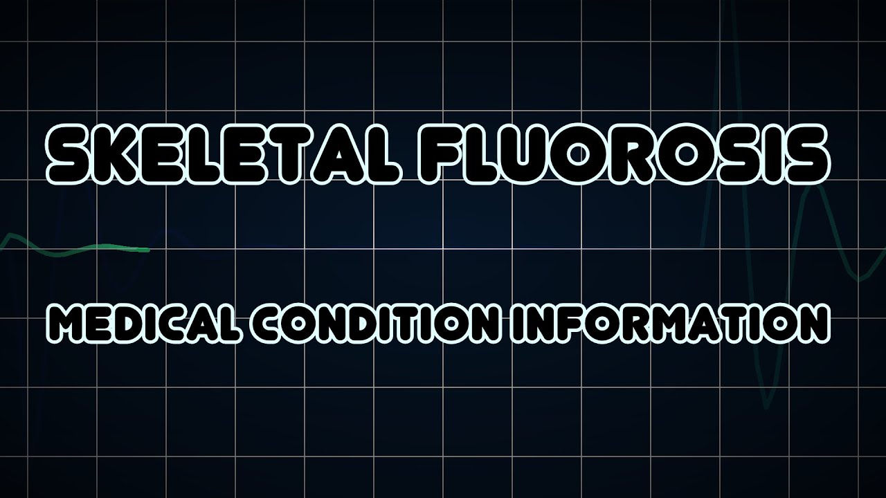 Skeletal fluorosis (Medical Condition) - YouTube