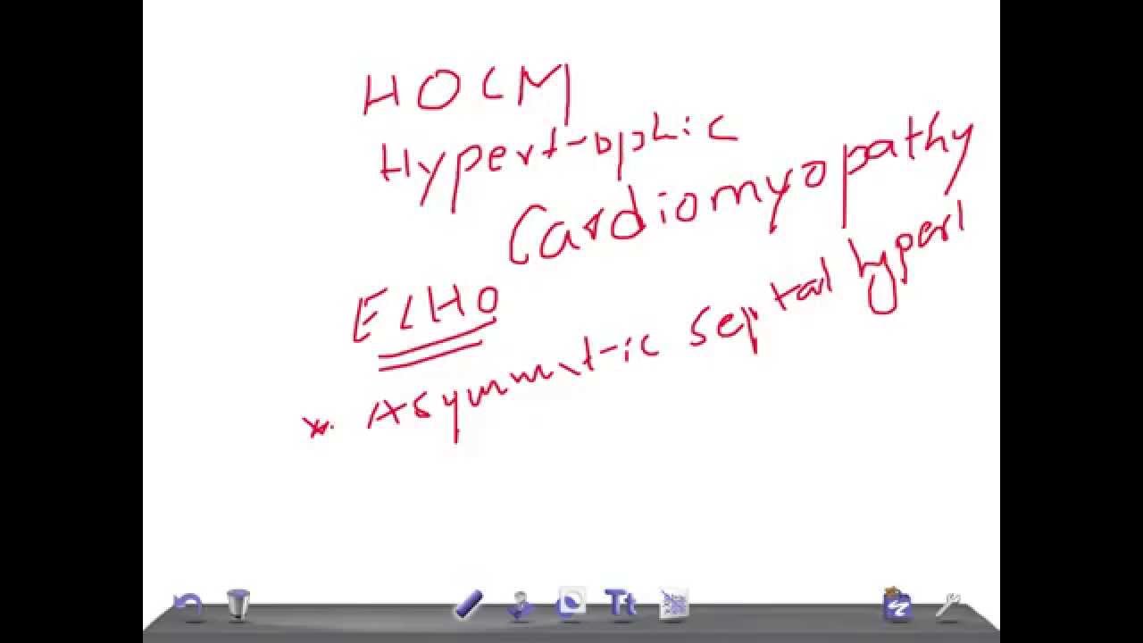 QUICK RADIOLOGY: Echocardiography signs of Hypertrophic cardiomyopathy ...