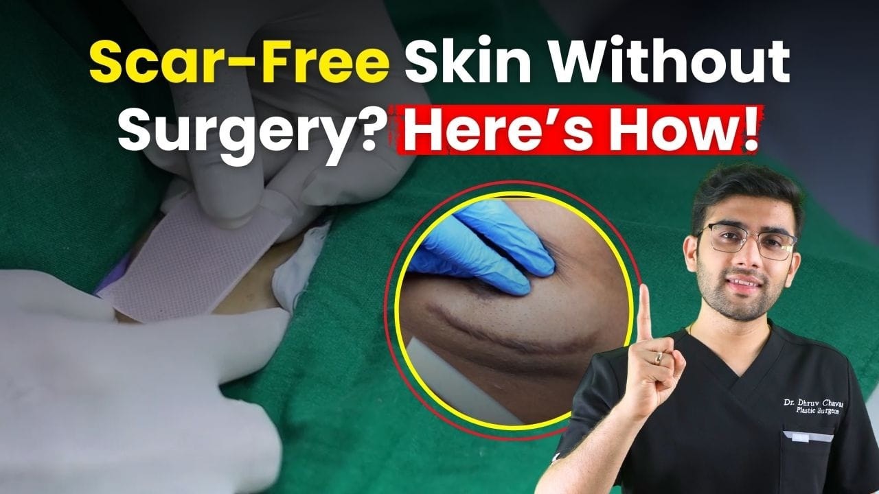 How to Remove ANY Scar Without Surgery: सच में काम करेगा? | Non ...