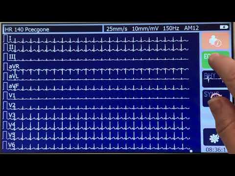 Powerchart ECG - YouTube