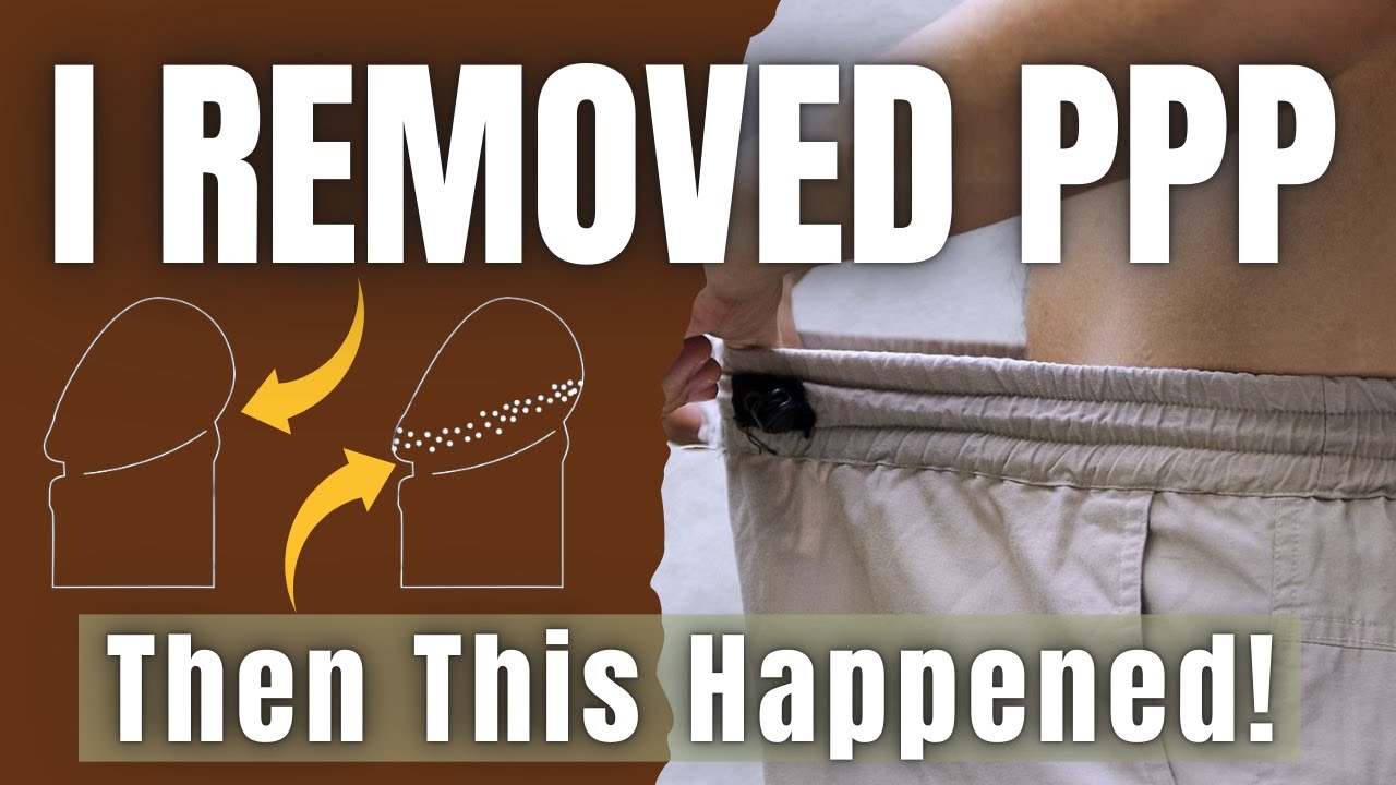 WARNING: Does PPP Grow Back After Removal? (The Truth) - YouTube