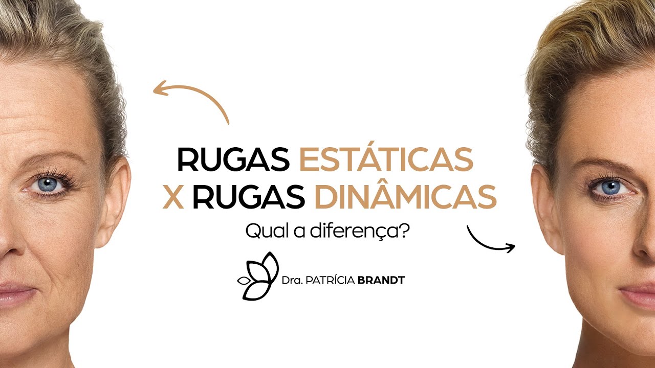 RUGAS ESTÁTICAS X RUGAS DINÂMICAS: QUAL A DIFERENÇA? - YouTube