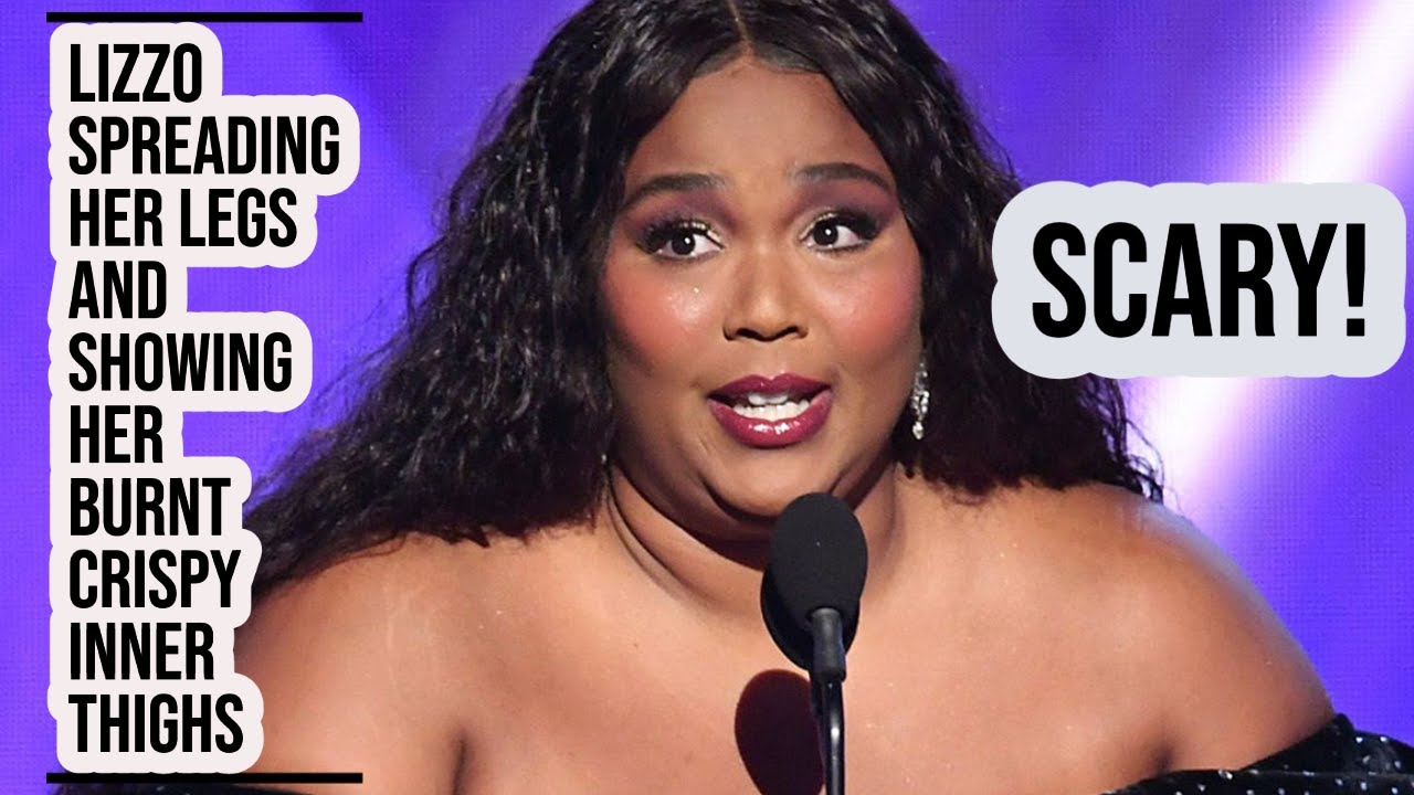 LIZZO SPREADING HER LEGS AND SHOWING HER BURNT CRUSTY INNER THIGHS ...