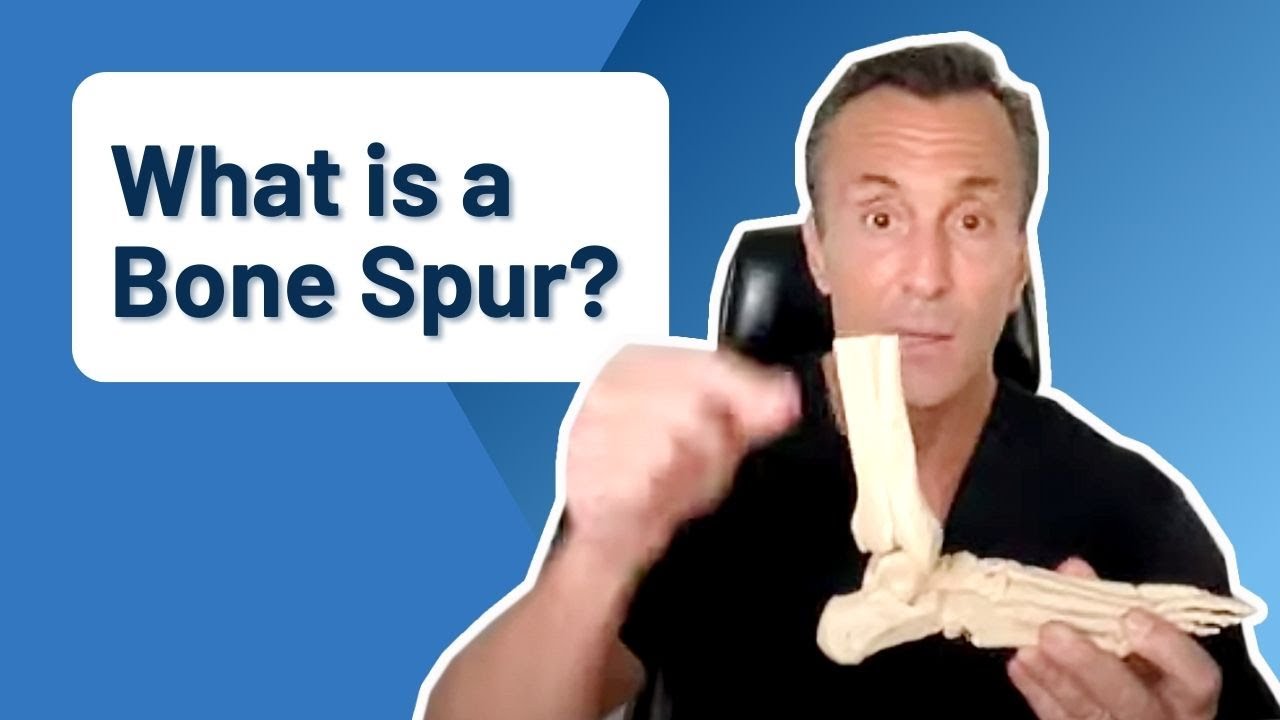 What Is a Bone Spur?? | Identifying Foot Pain Problems - YouTube