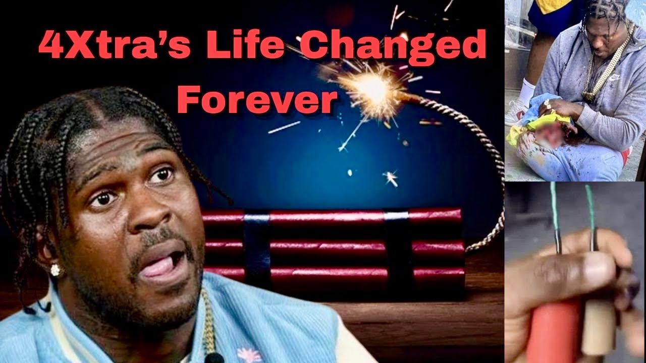 4Xtra’s Life Changed Forever After Explosive Fireworks Mishap - YouTube