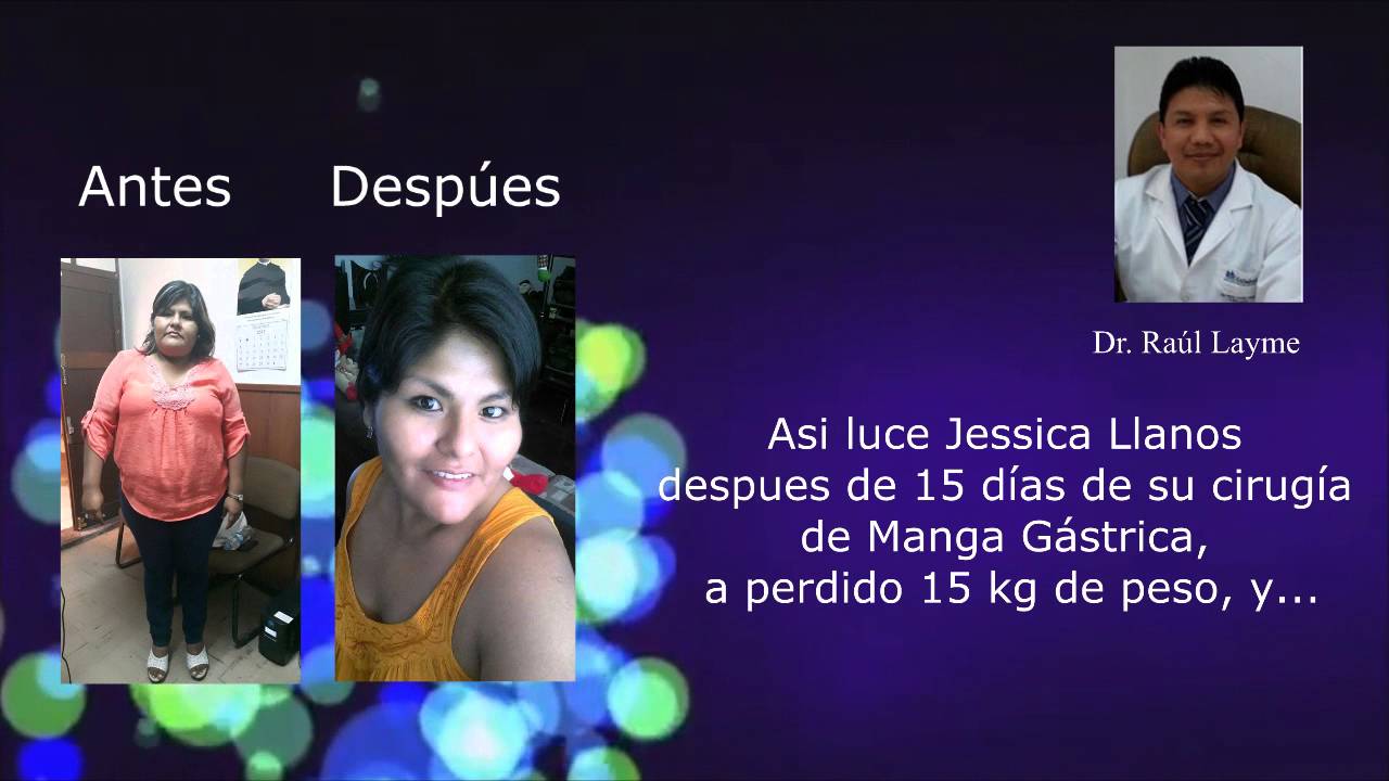 Manga Gástrica - Jessica Llanos - Dr. Raul Layme - YouTube