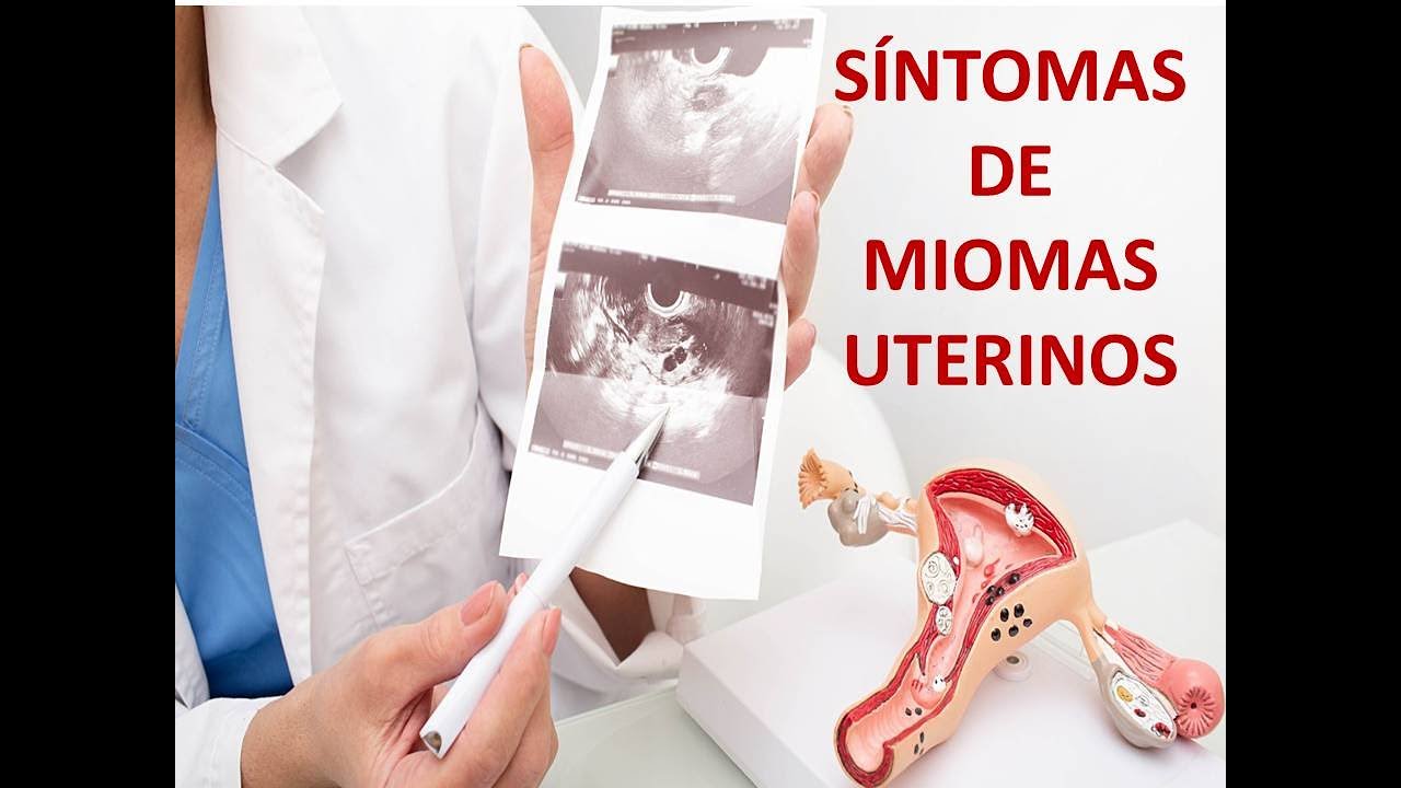 ¿PORQUÉ ME DUELE EL VIENTRE? MIOMAS? SINTOMAS? - YouTube