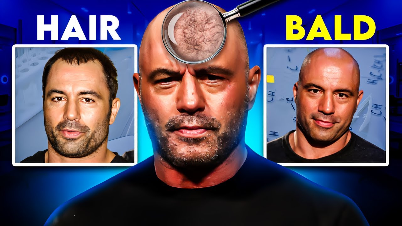 How is Joe Rogan Bald Despite 3 Hair Transplants!? - YouTube