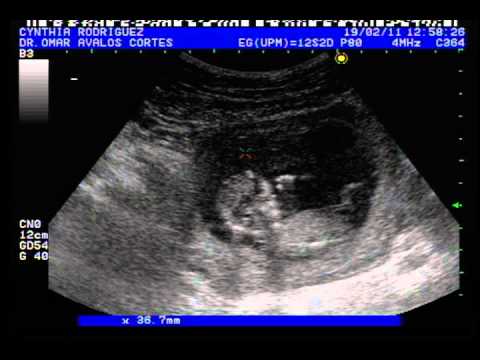 Bebé Moreno Rodríguez [3 meses] - YouTube