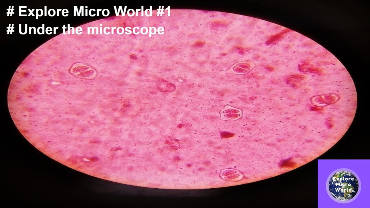 🌎 Explore micro world under microscope 🔬 #1: Microbiology, mycology ...