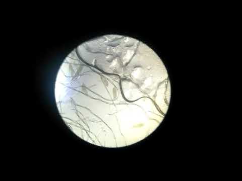 Protozoa.Hasil pengamatan di air jerami - YouTube