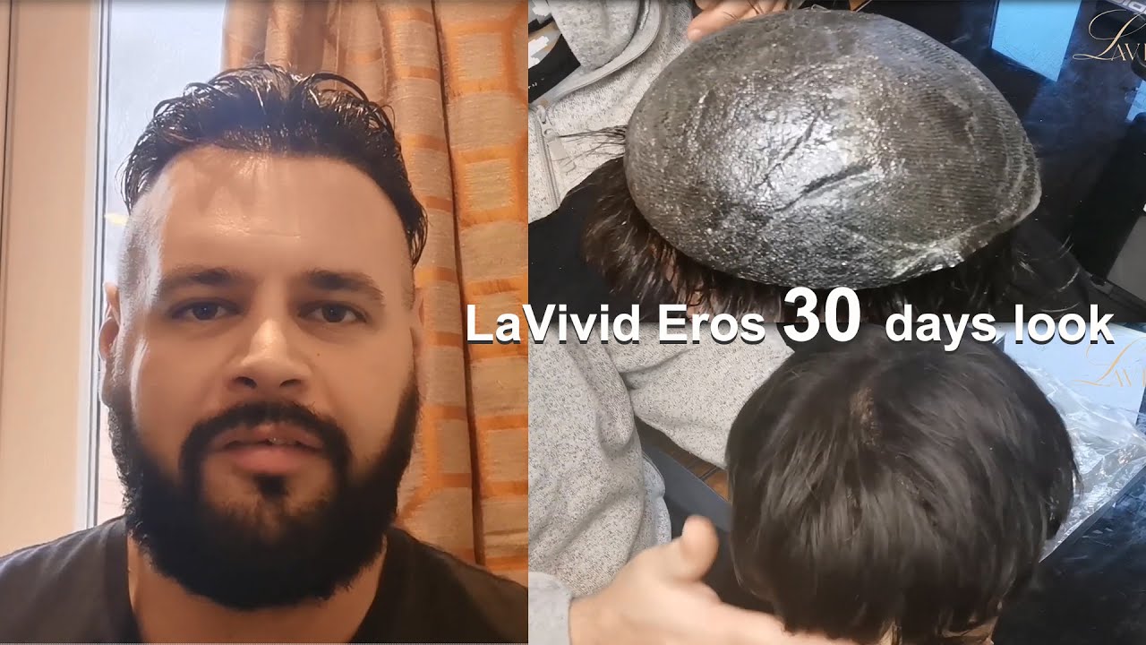 Lavivid Eros Hair System 30 Days Look | LaVivid Hair - YouTube