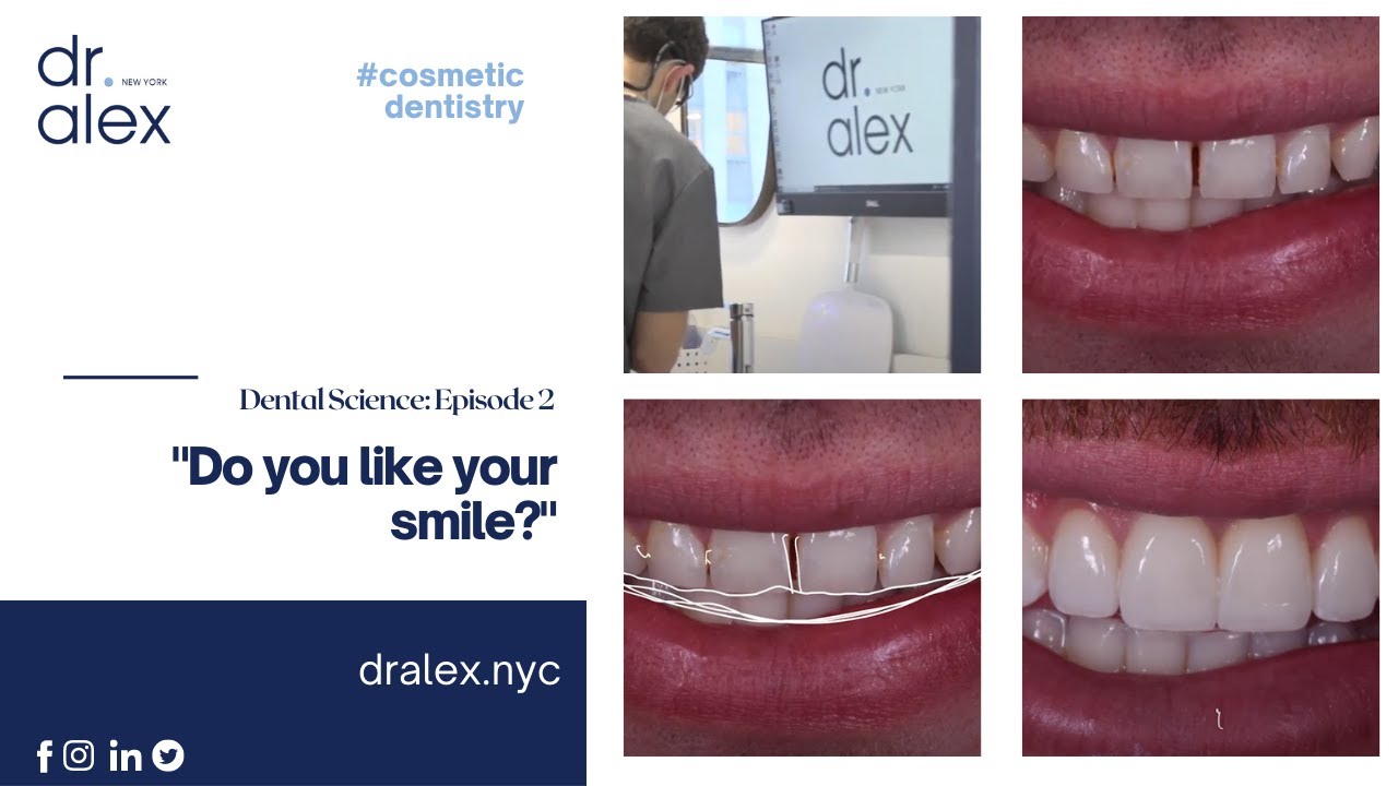 Do you like your smile? Dental Science Episode 2 - Dr. Alex Rubinov ...