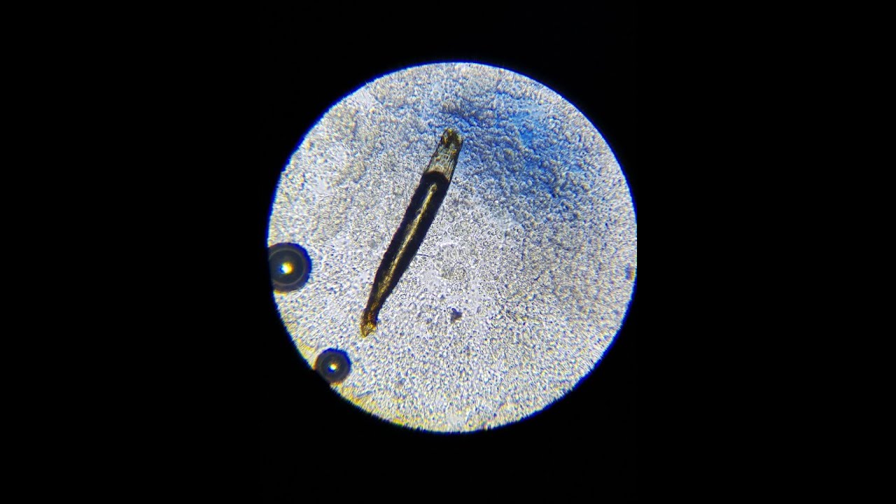 Koi Pond Parasite Treatment Potassium Permanganate (PP) - YouTube