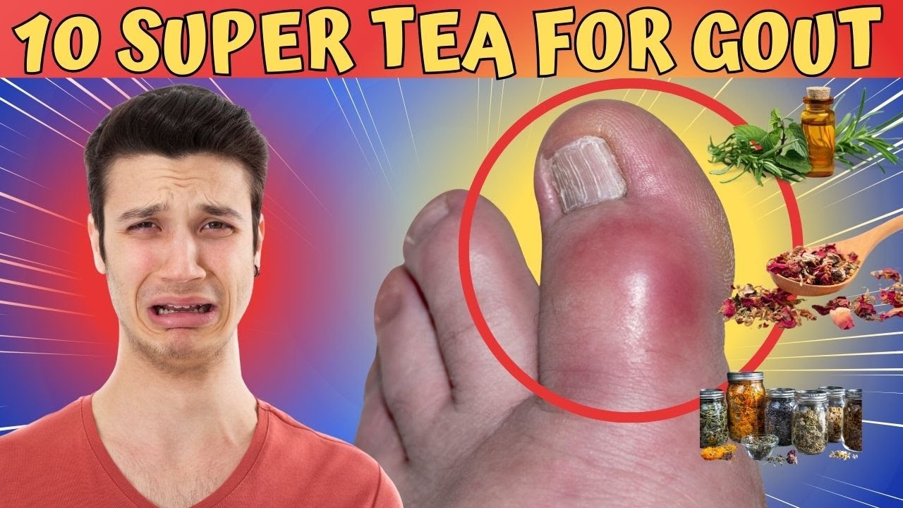 Best 10 Super Tea for Gout - YouTube