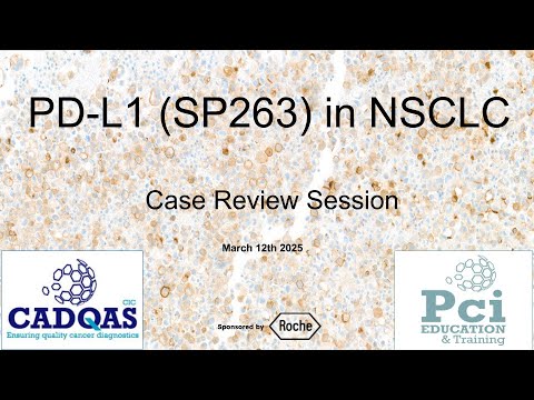 CADQAS Proficiency Test Case Review Session for PT 623 (PD-L1 (SP263 ...