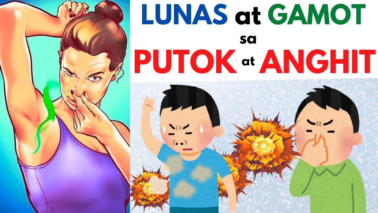 💥 Paano mawala ang PUTOK o ANGHIT? | Epektibong Gamot at Lunas para sa ...