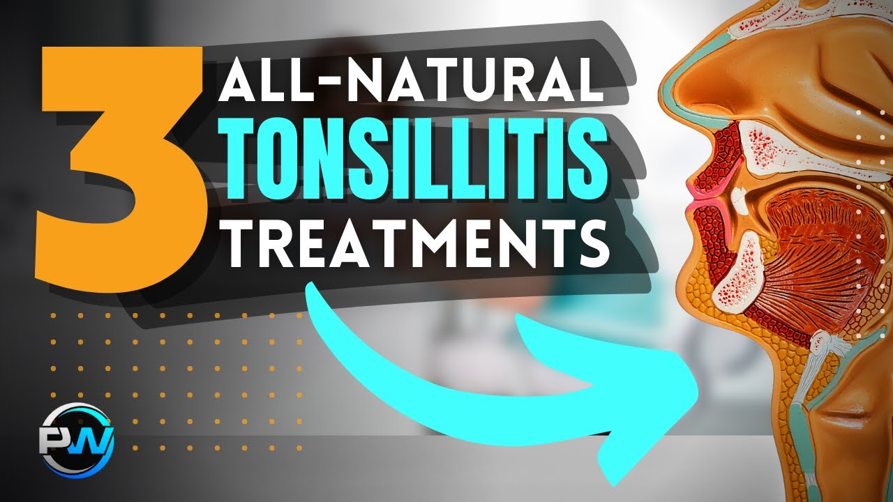 Tonsillitis Treatment