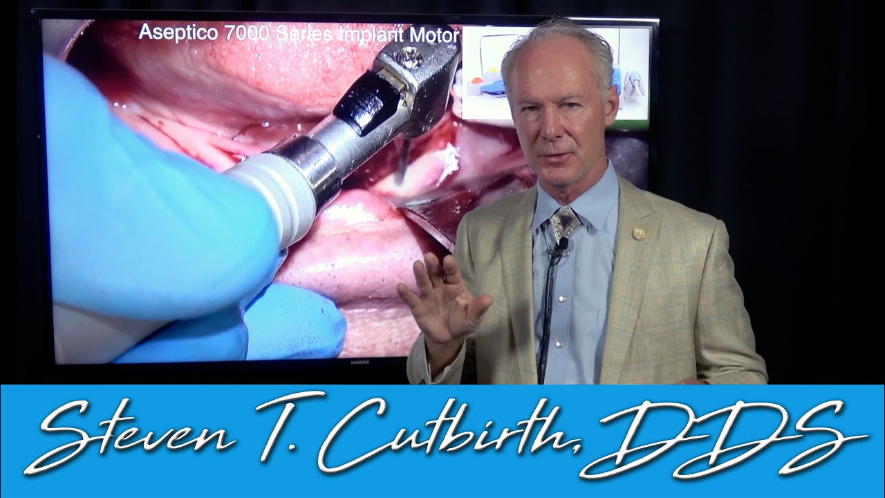 Placing Mandibular Small Diameter Implants - Dental Minute with Steven ...