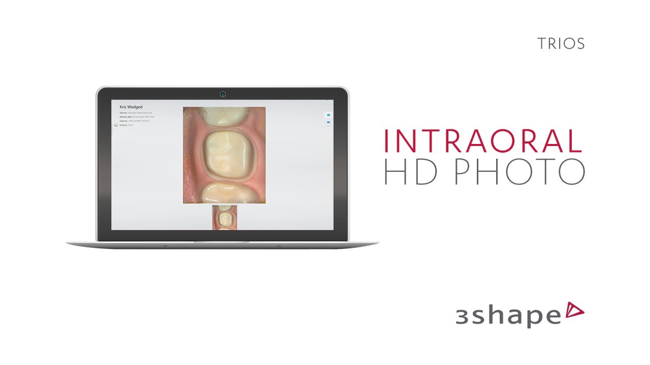 3Shape TRIOS - HD Photo - YouTube