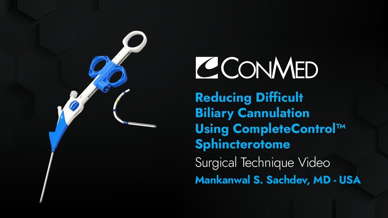 Dr. Mankanwal Sachdev - Reducing Difficult Biliary Cannulation Using ...