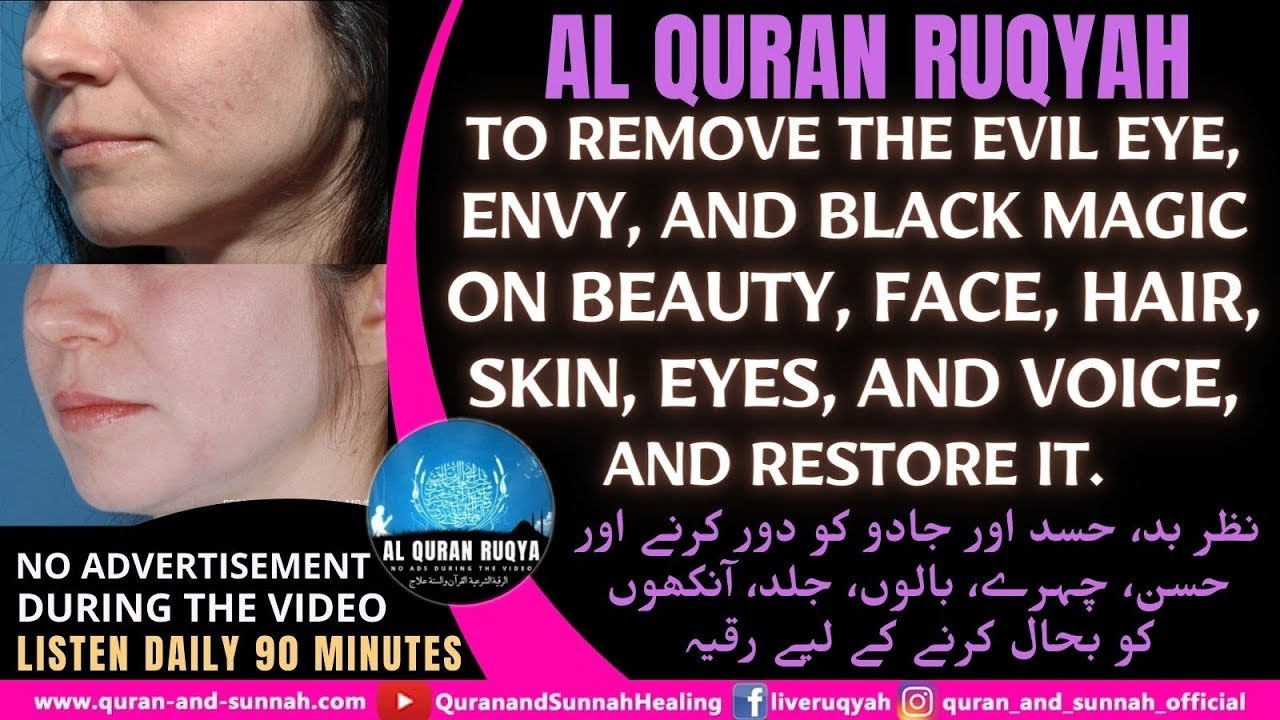 RUQYAH FOR REMOVAL OF THE EVIL EYE, ENVY AND MAGIC ON BEAUTY, FACE ...
