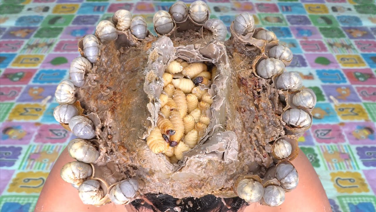 Itchy Dry Scalp Dandruff Removal Satisfying Maggot Worms Biggest Hole ...