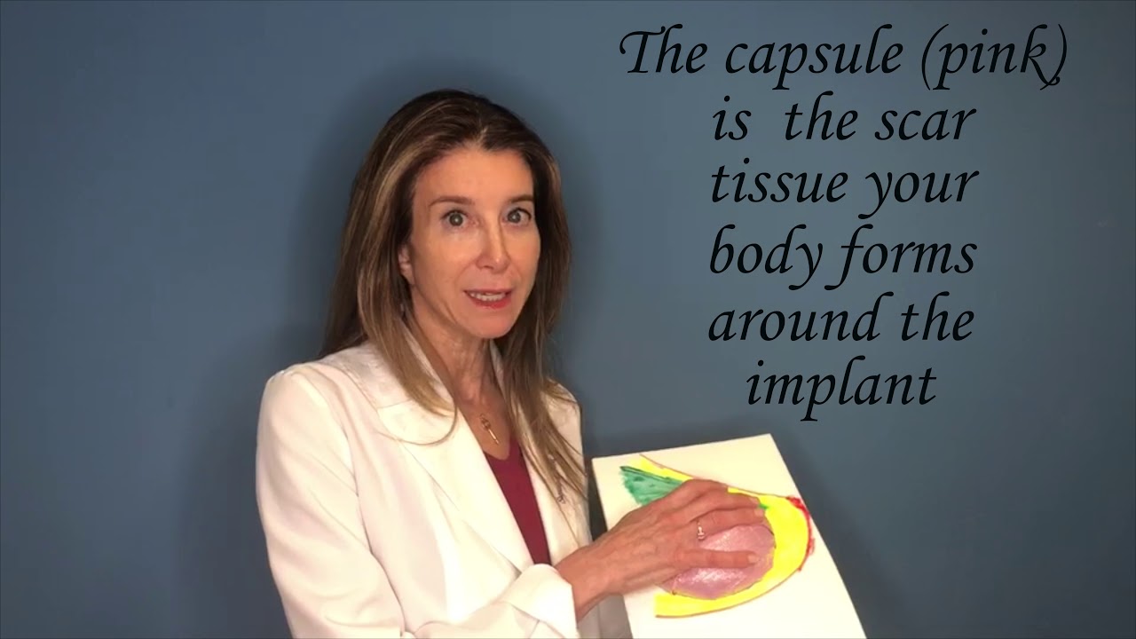 En Bloc Resection - YouTube