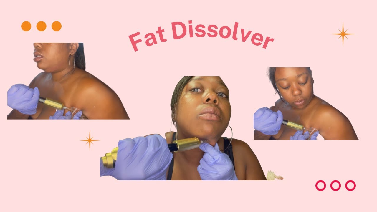 Fat dissolver on double chin & bra fat - YouTube