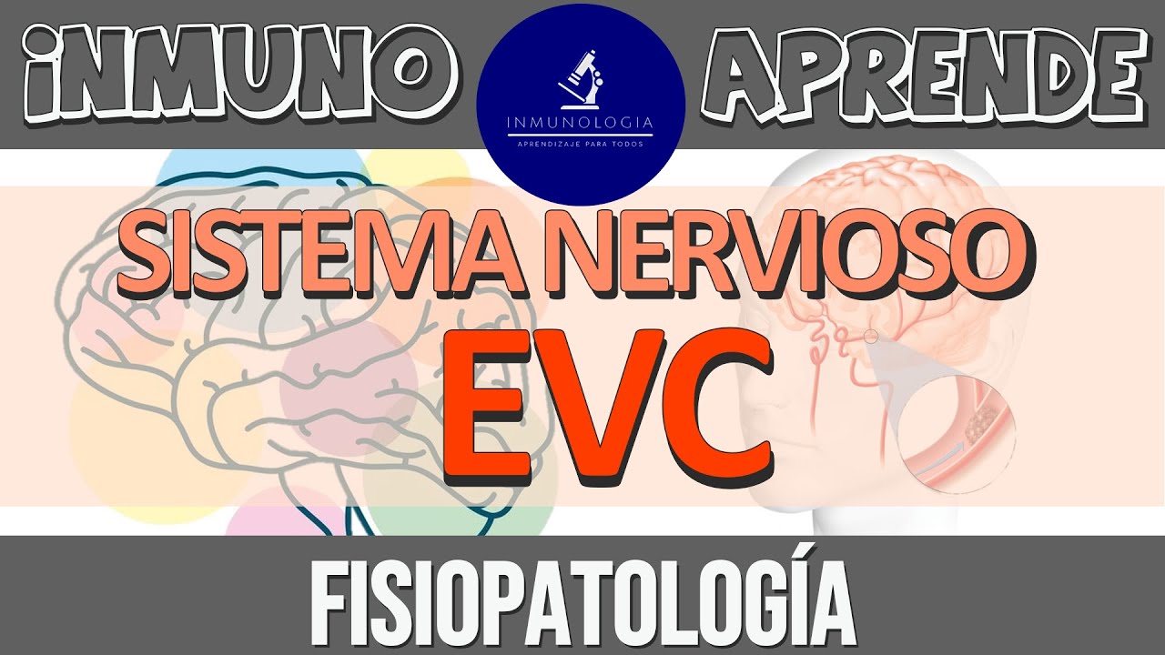 EVC: Fisiopatología | Anatomía neurovascular - Presentación clínica ...