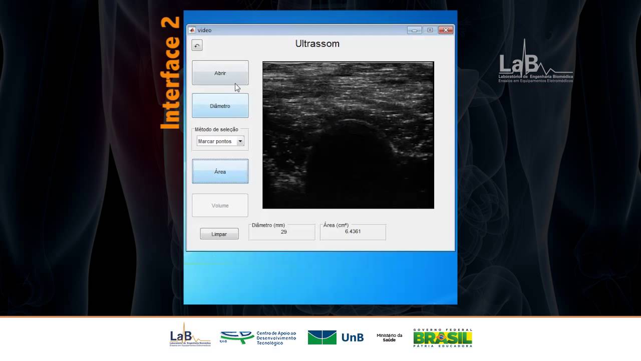 Sofia Software - Processamento de Imagens, Interface com o usuário ...