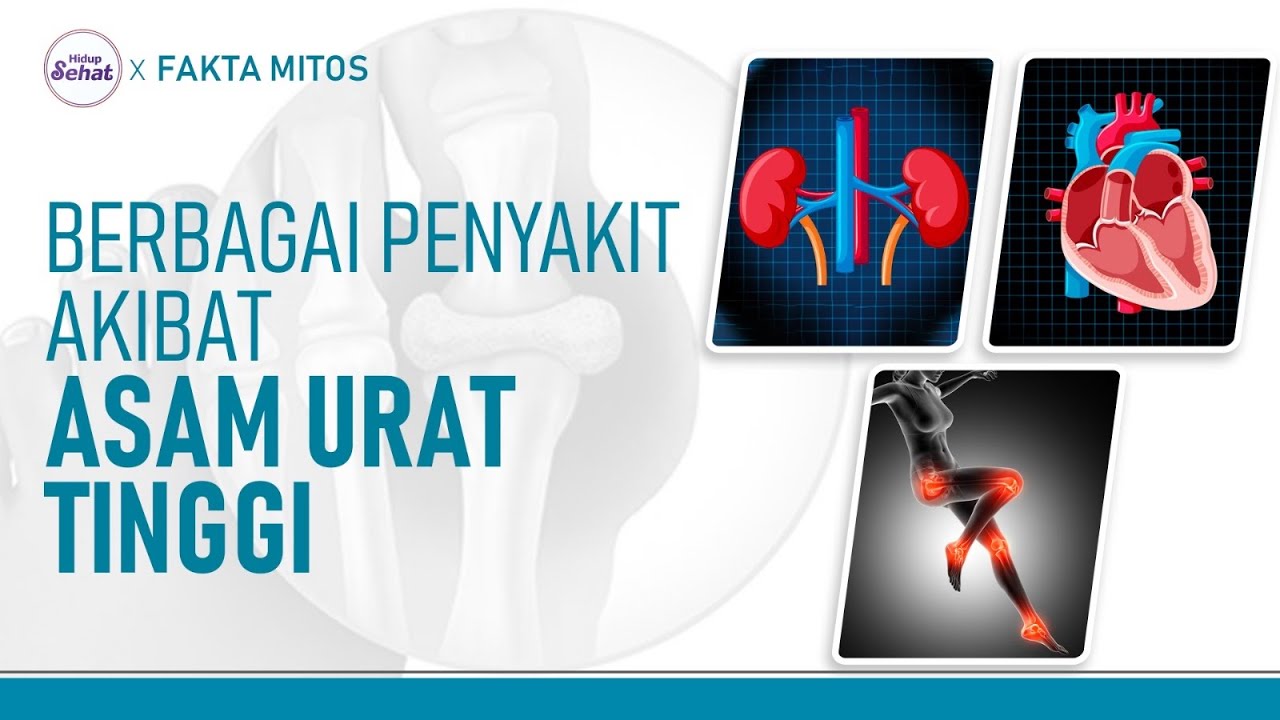 Pengaruh Asam Urat Tinggi Pada Tubuh | Hidup Sehat tvOne - YouTube