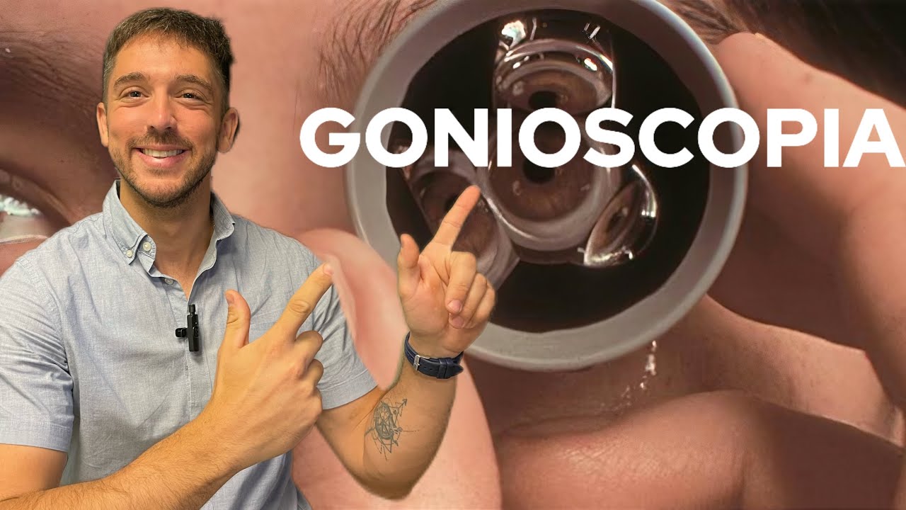 GONIOSCOPIA y su importancia para el diagnóstico de GLAUCOMA 🤯 - YouTube