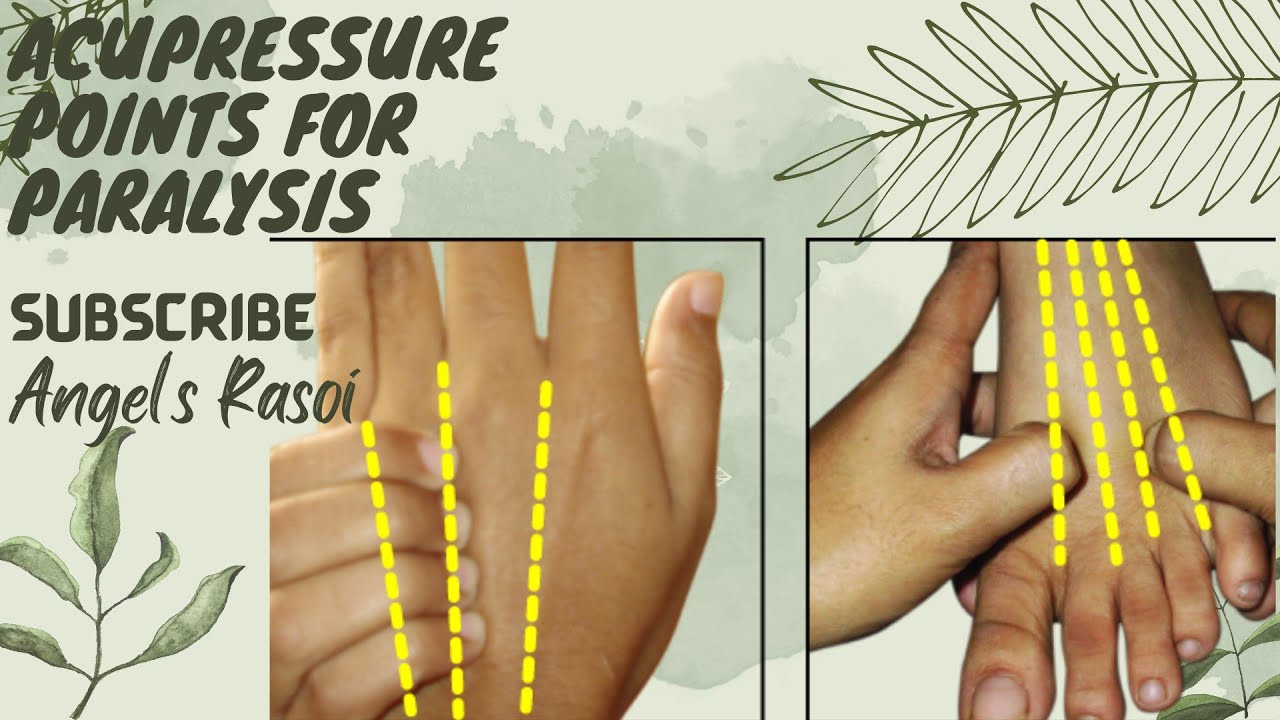 Acupressure Se Lakwa Ka ilaj | Acupressure Points for Muscle Weakness ...