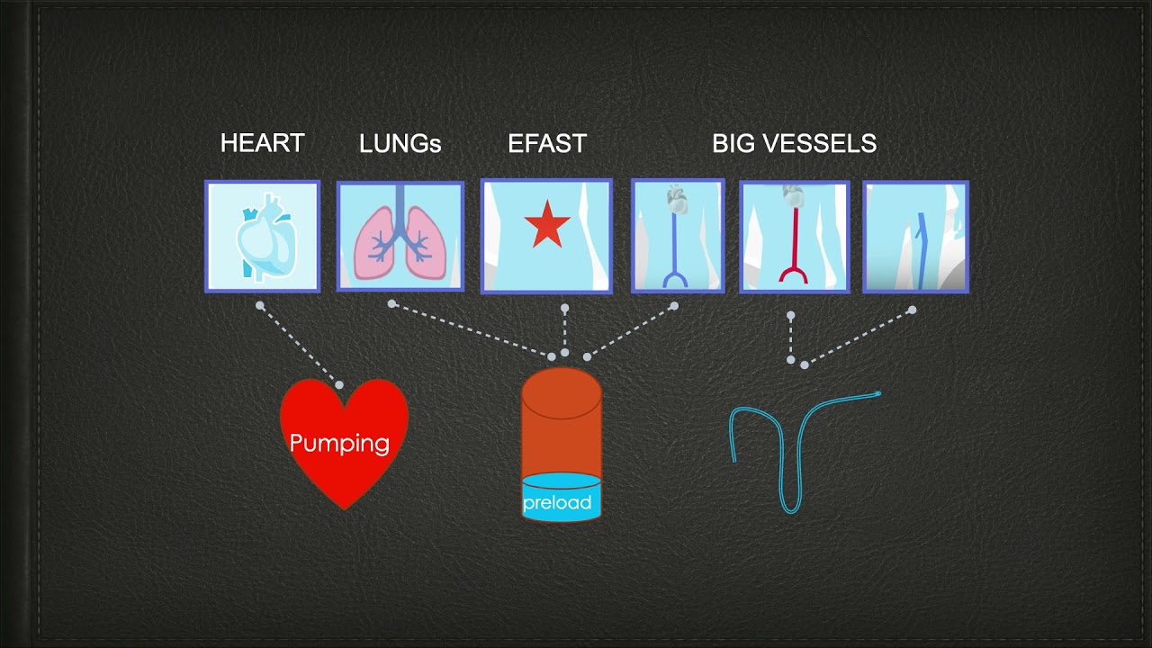 PoCUS: Shock approach - YouTube