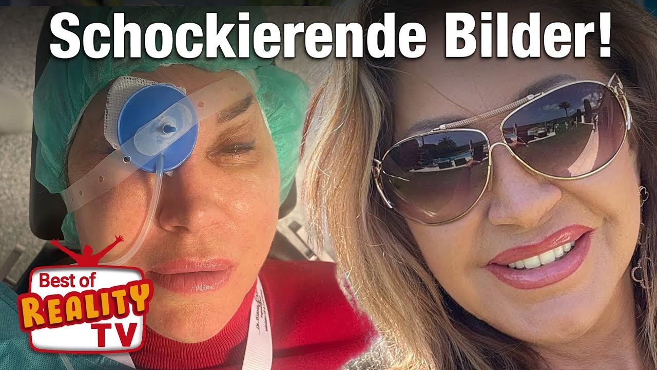 Carmen Geiss zeigt schockierende OP-Bilder: So geht es ihnen nach Augen ...