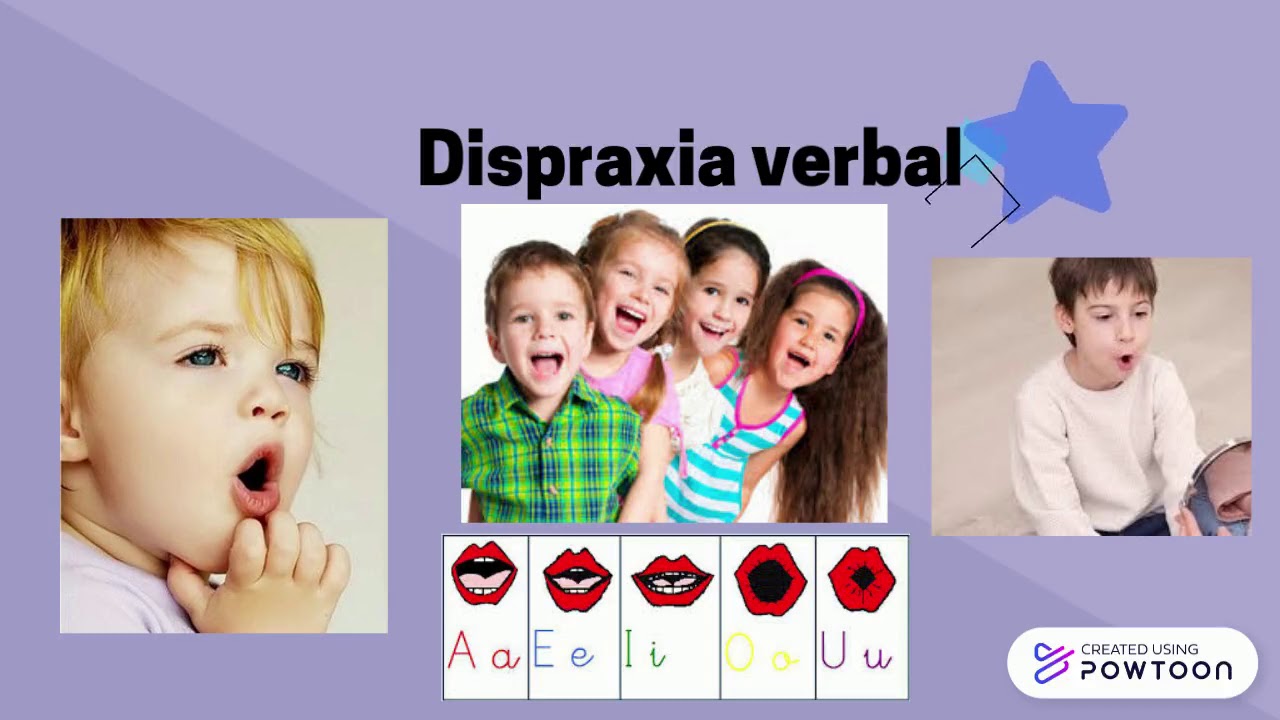 Dispraxia verbal parte 1 - YouTube