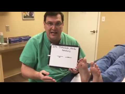 Plantar Warts/IPK - YouTube