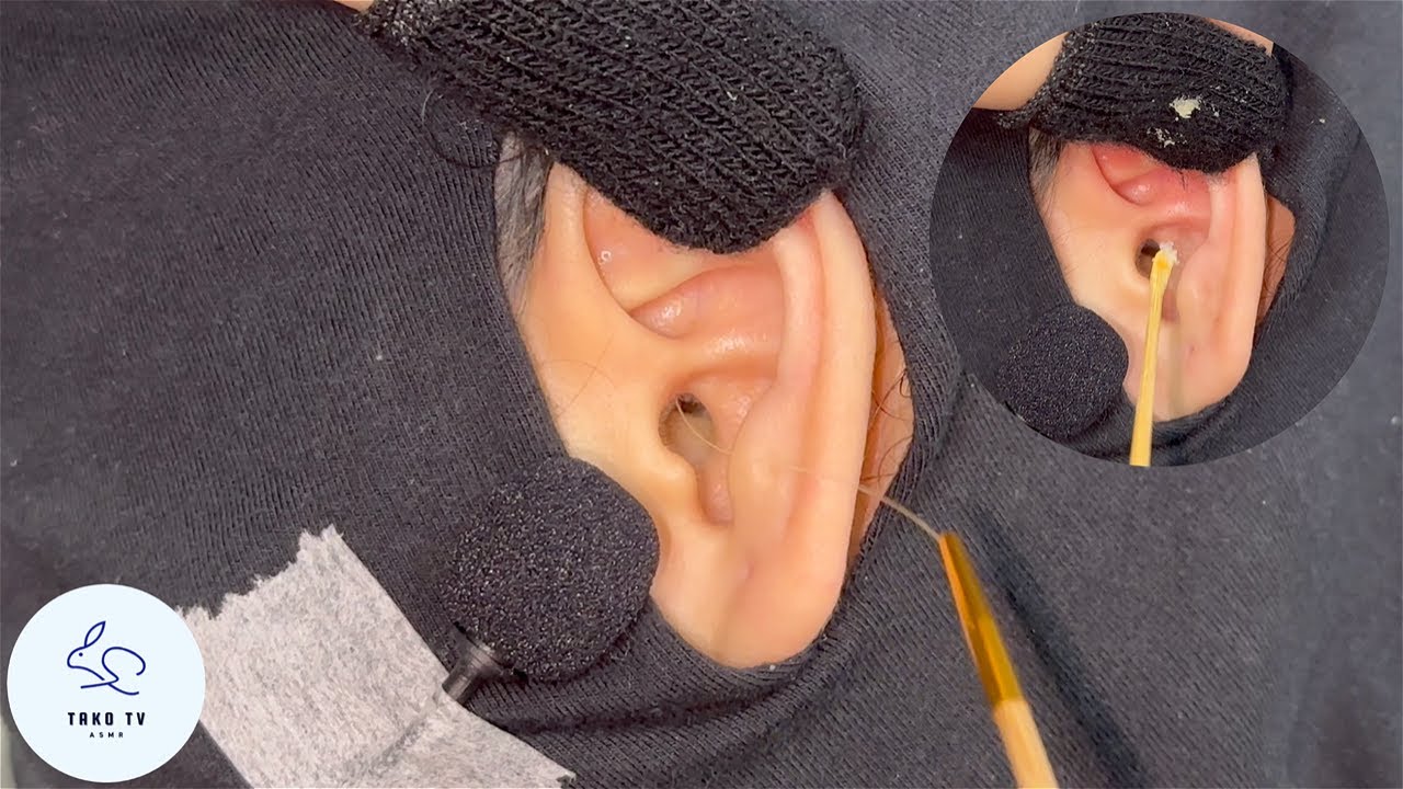 ASMR Real Ear Cleaning: Brain Melting Itching Sound 耳掃除 귀청소 采耳 - YouTube