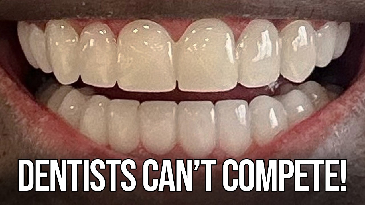 Perfect Teeth - 7 Day Smile Makeovers for Less than $1,000 - Brighter ...