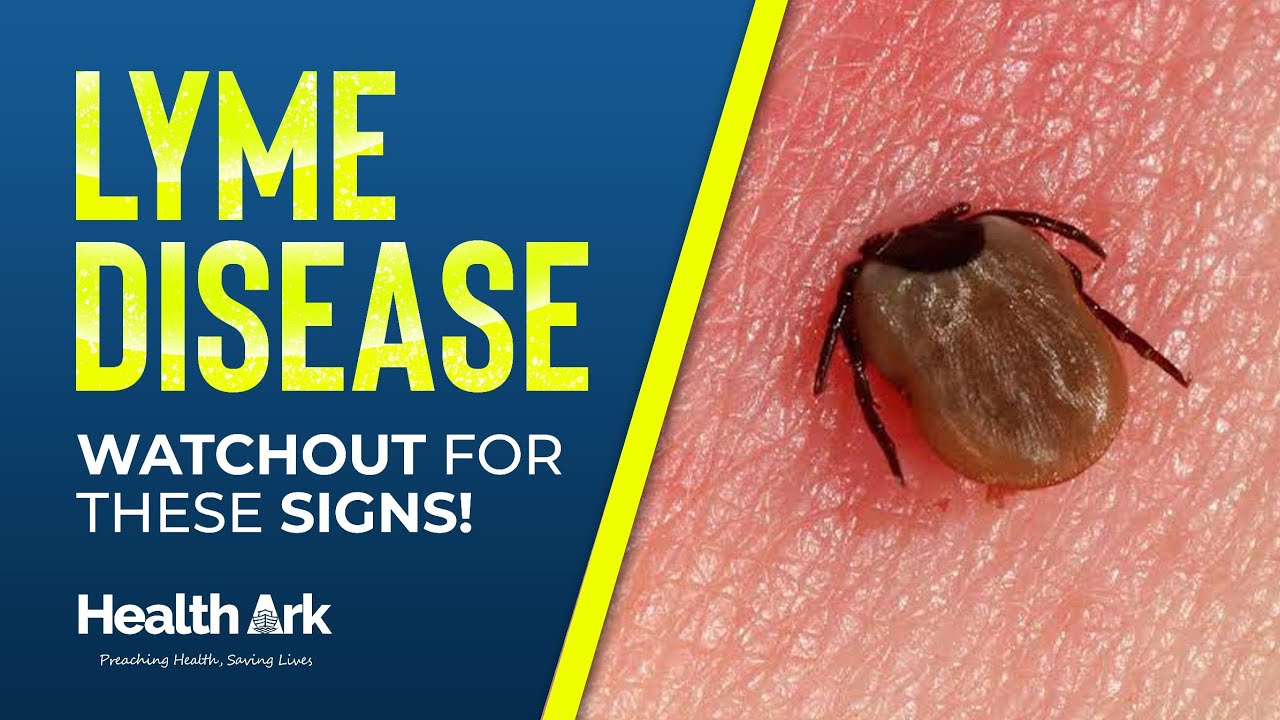 Lyme Disease Explained:Symptoms, Risks, and How to Protect Yourself # ...