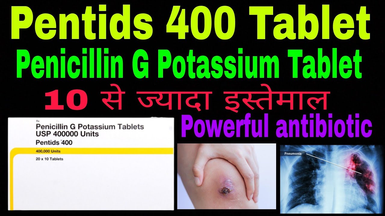 pentids 400 tablets used for | penicillin g potassium tablets ...