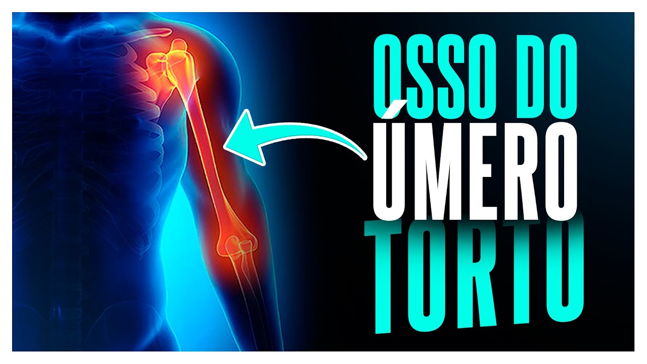 Osso Do Umero Anterior