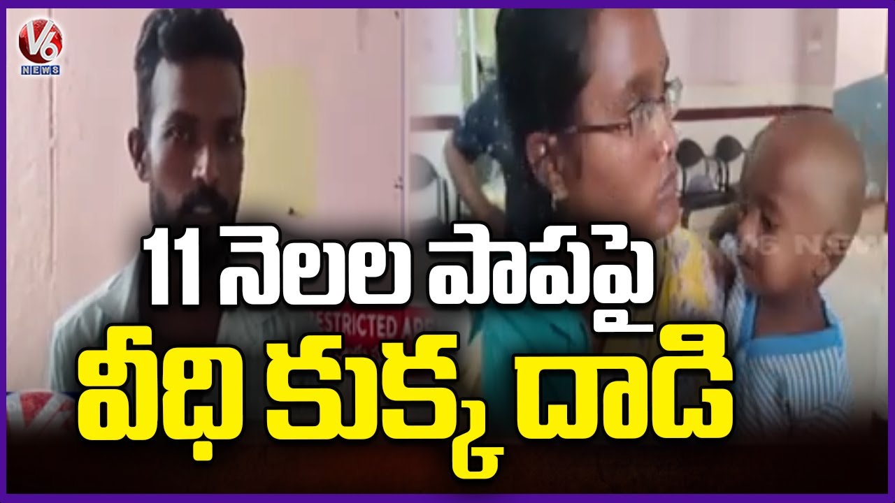 Street Dog Strike On 11 Months Baby At Bathkapalli | Jagtial | V6 News ...