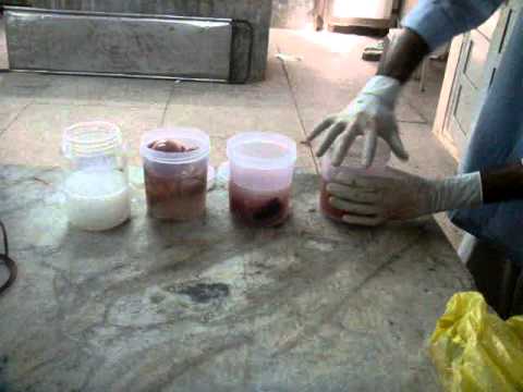 Viscera Preservation during Autopsy for a case of Poisoning - YouTube