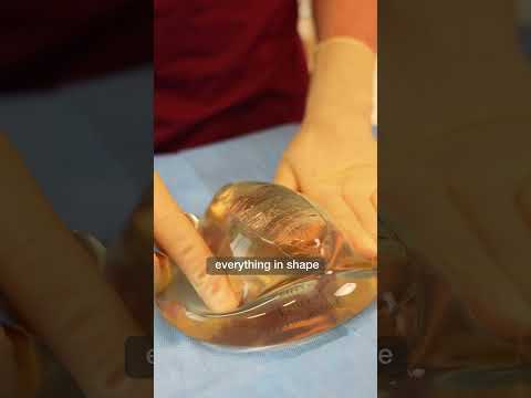 Will a silicone implant leak into your body if it ruptures?