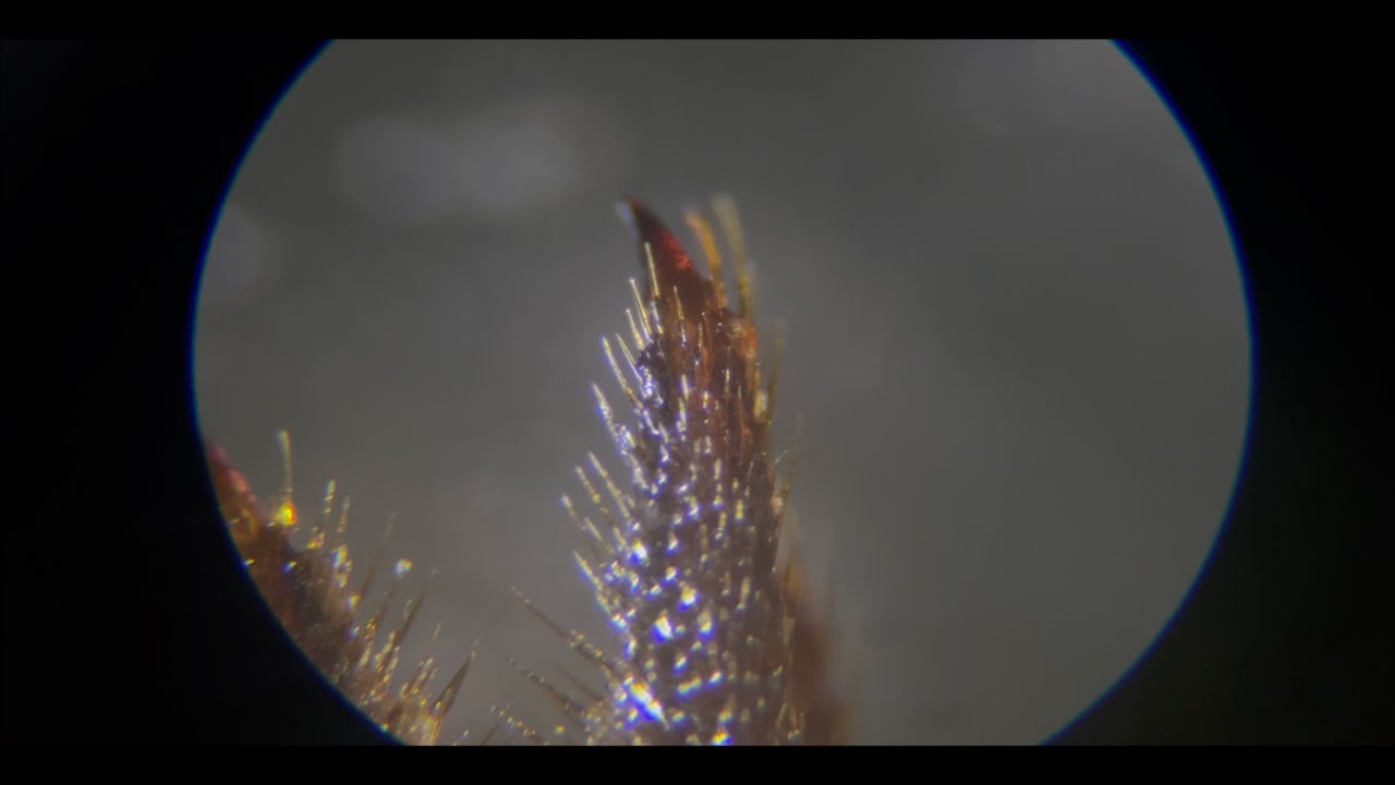 Bacteria infested cricket under a microscope (Creepy video ...