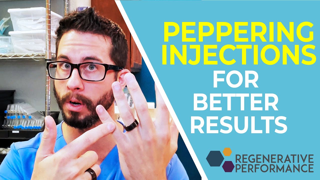 Peppering Injections for better results - YouTube