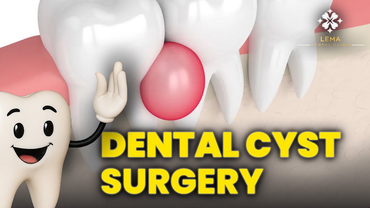 🤍 What is Dental Cyst Surgery? How is it Performed? - Lema Dental ...